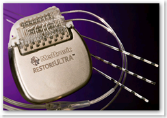 Medtronic Receives U.S. FDA Approval for New Neurostimulator with ...